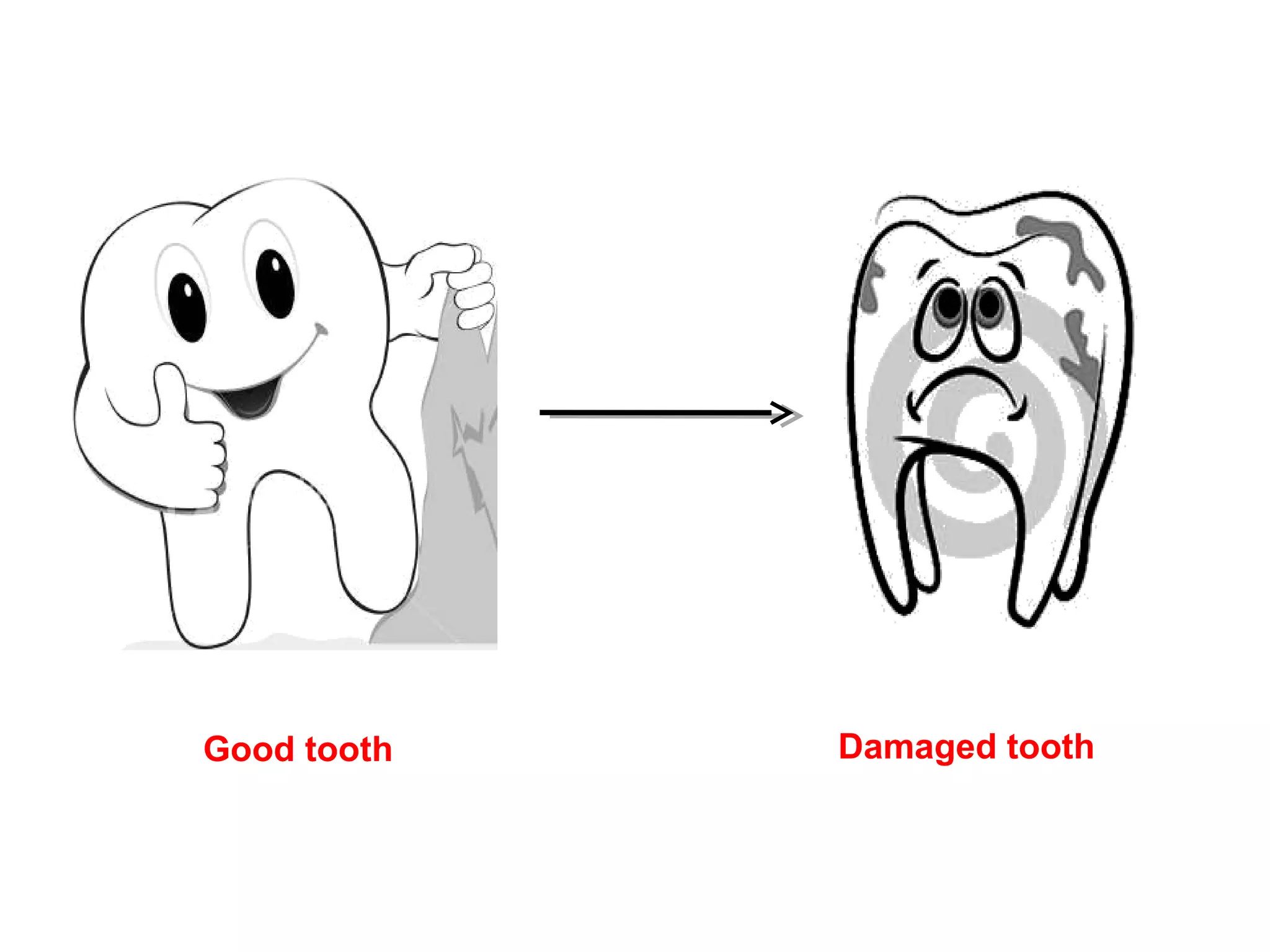 063 tooth decay | PPT