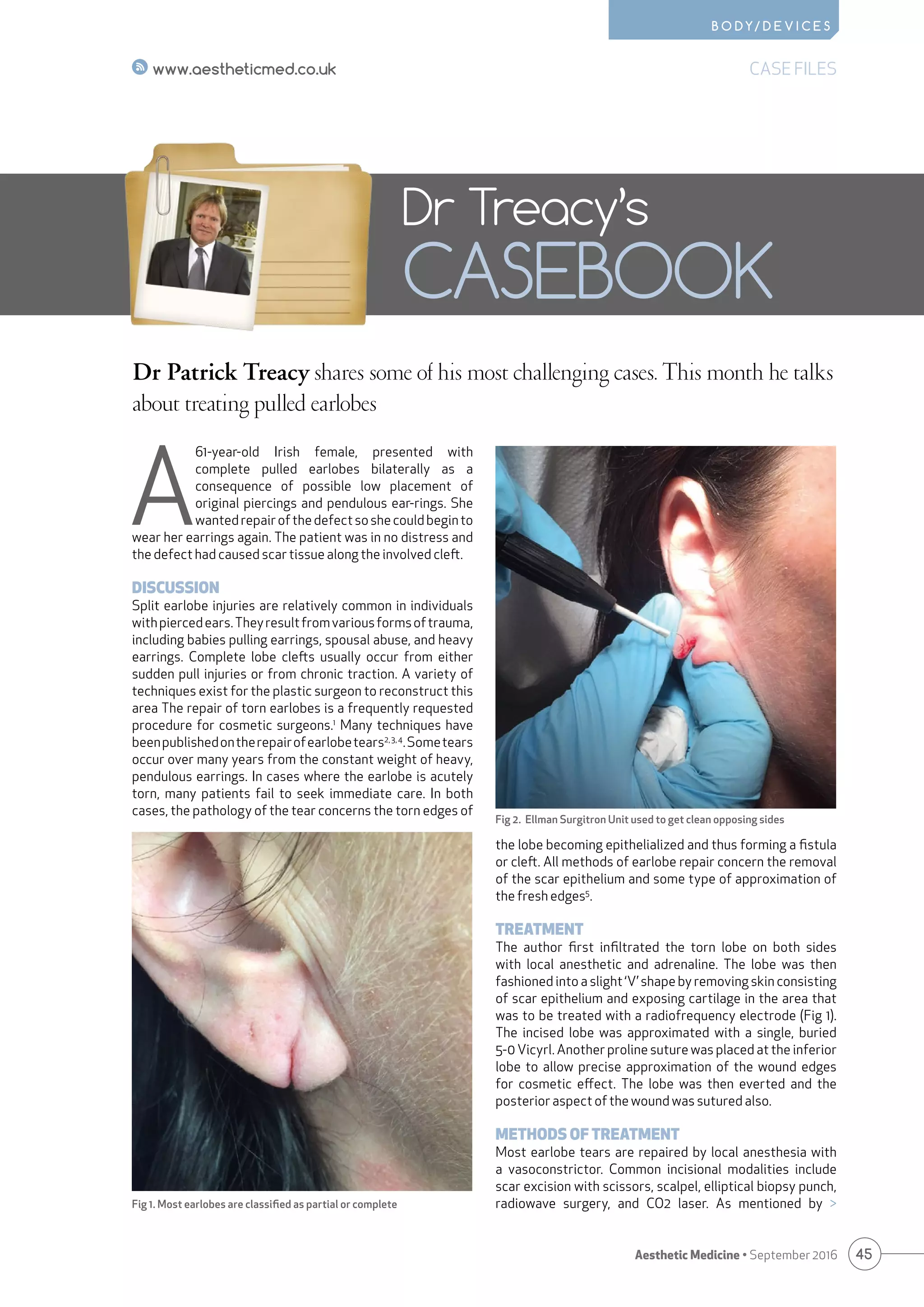 Dr Patrick Treacy shares some of his most challenging cases. This month ...