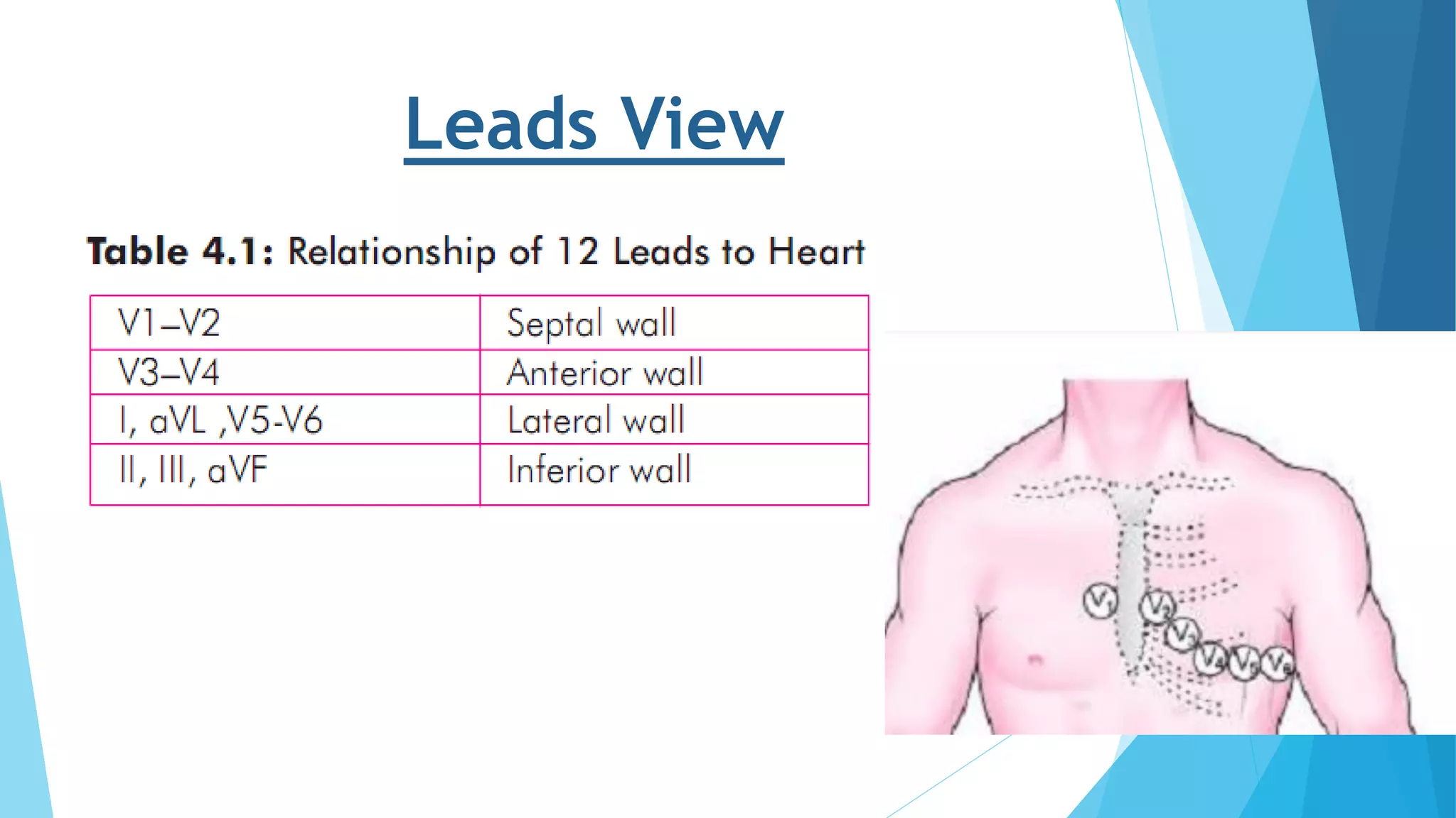 ECG slides shaza PDF | PDF