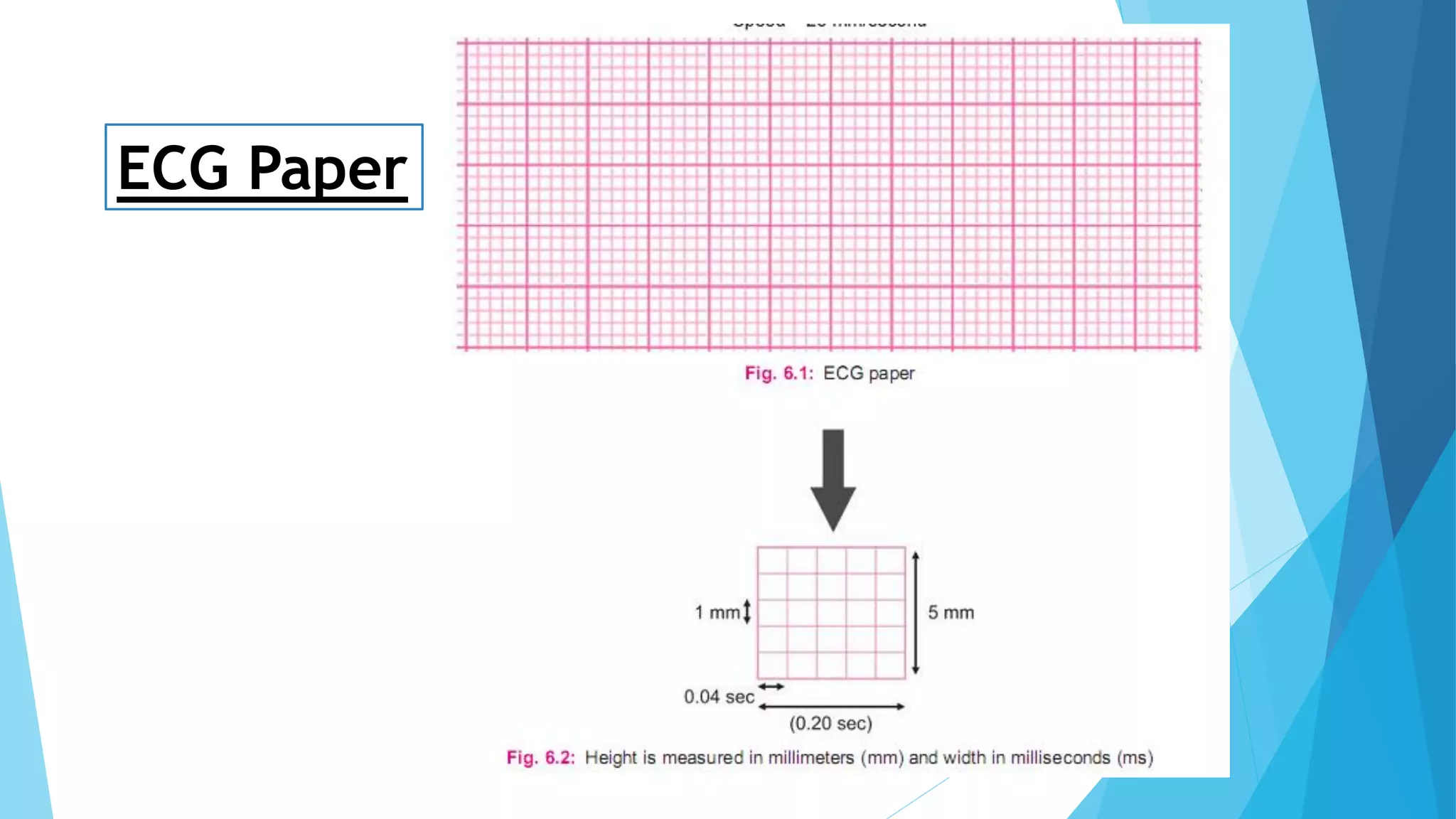 ECG slides shaza PDF | PDF