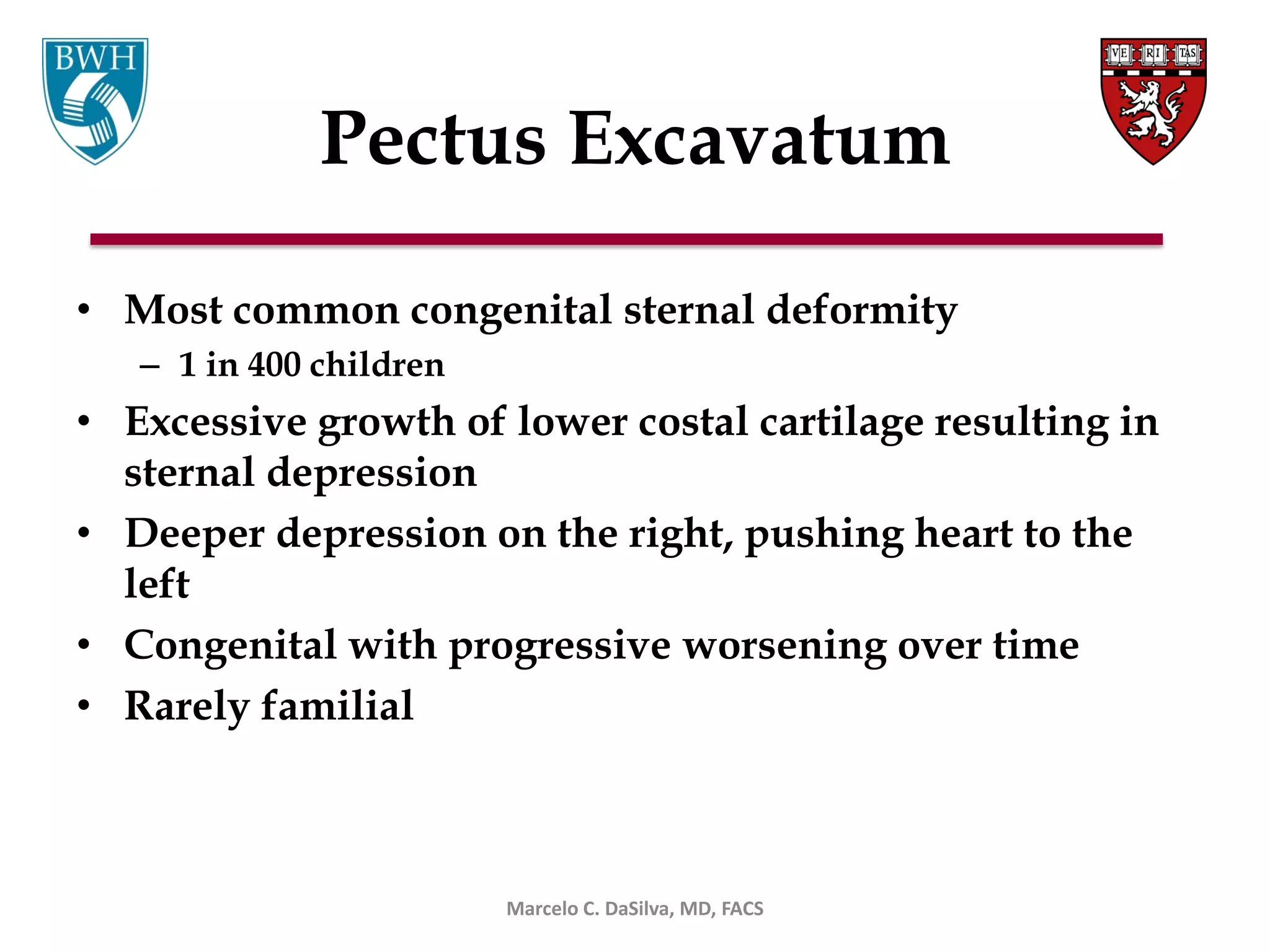 Pectus Excavatum | PDF