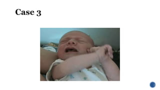 Apparent Life-Threatening Events | PPT