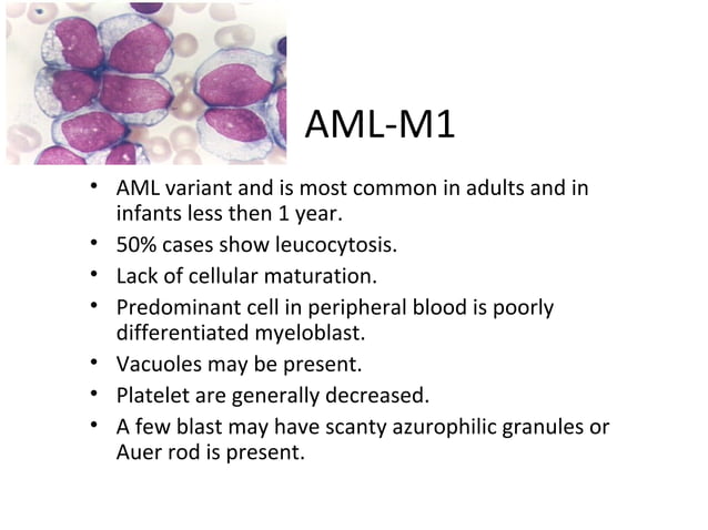 AML vs ALL 5th Semester | PPT