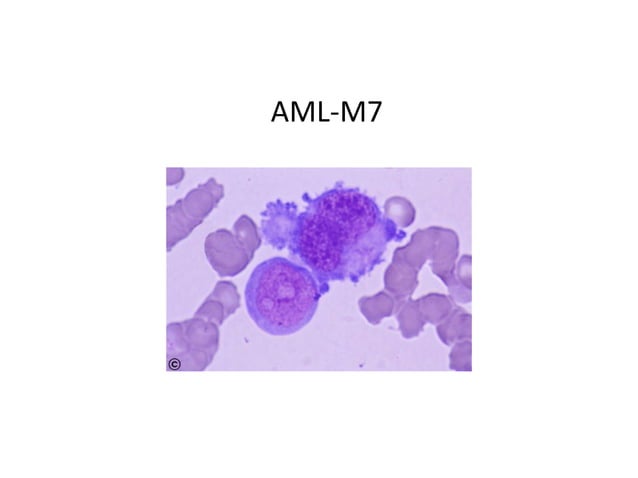 AML vs ALL 5th Semester | PPT