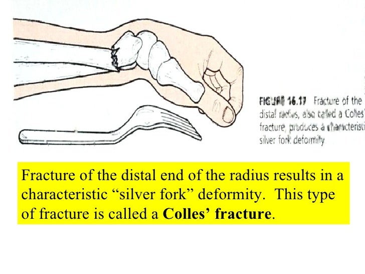 06 Appendicular Skeleton Pectoral Girdle And Upper Limbs