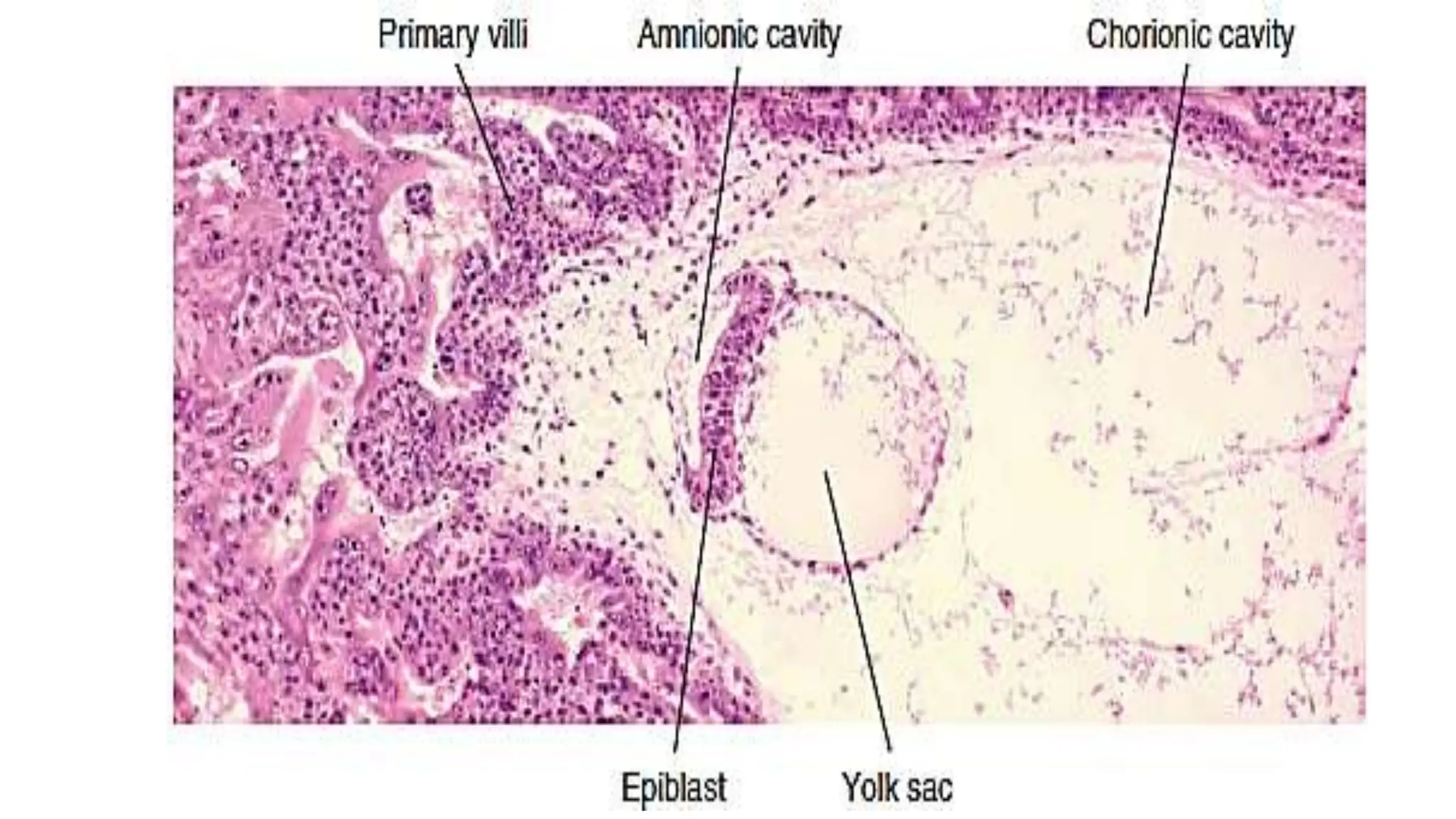06 Bilaminar Germ Disc by Dr. Rabia I. Gandapore.pptx