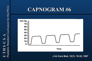 06 capnography and pulseoximetry | PPT