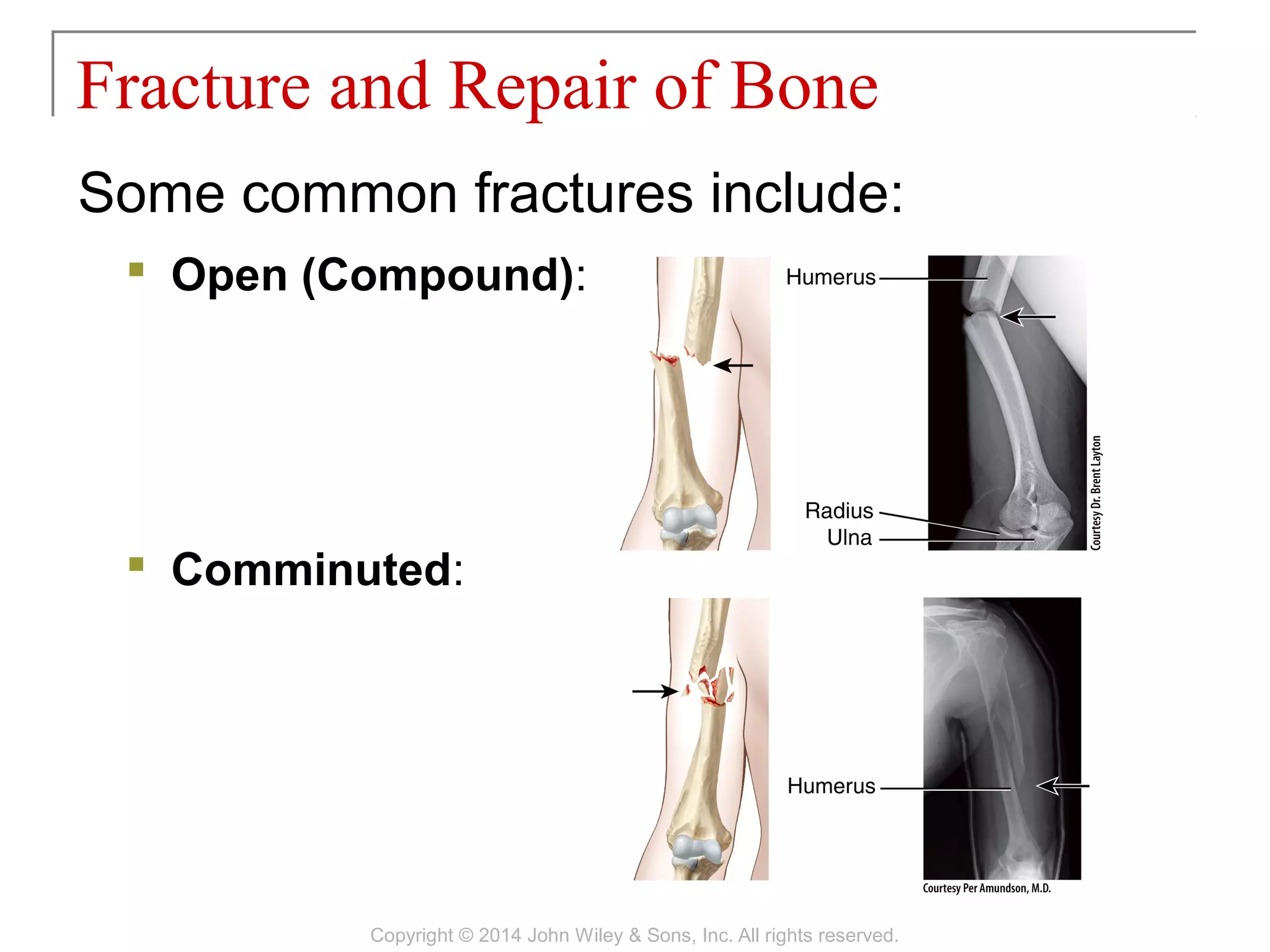 06 [chapter 6 the skeletal system bone tissue] | PPT