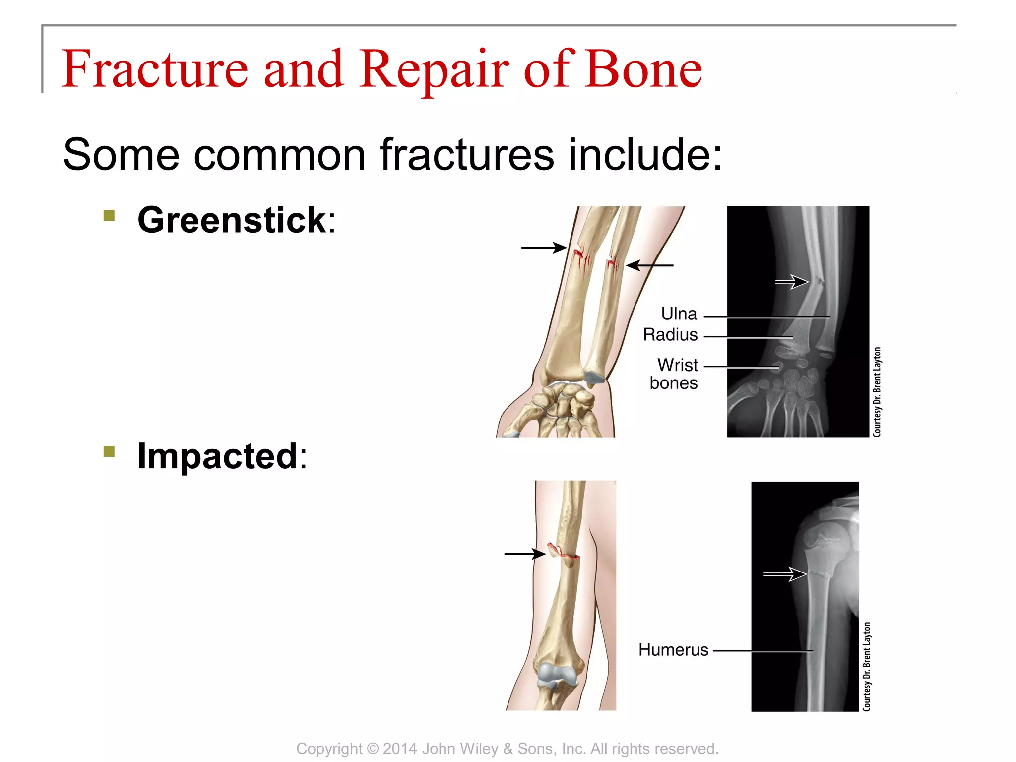 06 [chapter 6 the skeletal system bone tissue] | PPT