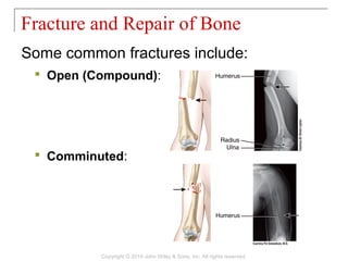 06 [chapter 6 the skeletal system bone tissue] | PPT