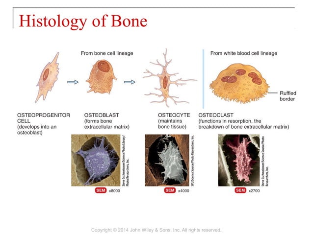 06 [chapter 6 the skeletal system bone tissue] | PPT | Bone and Joint Conditions | Diseases and ...