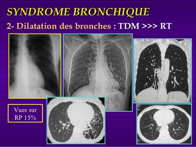 06 cours _eia_pn_semio_thx_partie.2.ppt