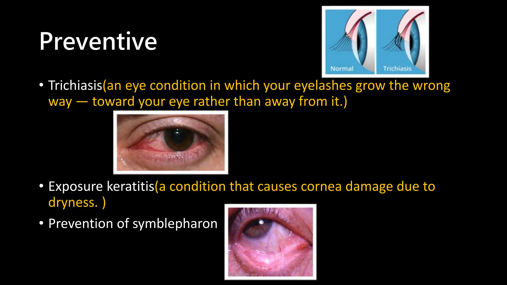 06 Indications & Contra Indications of Contact Lenses.pptx