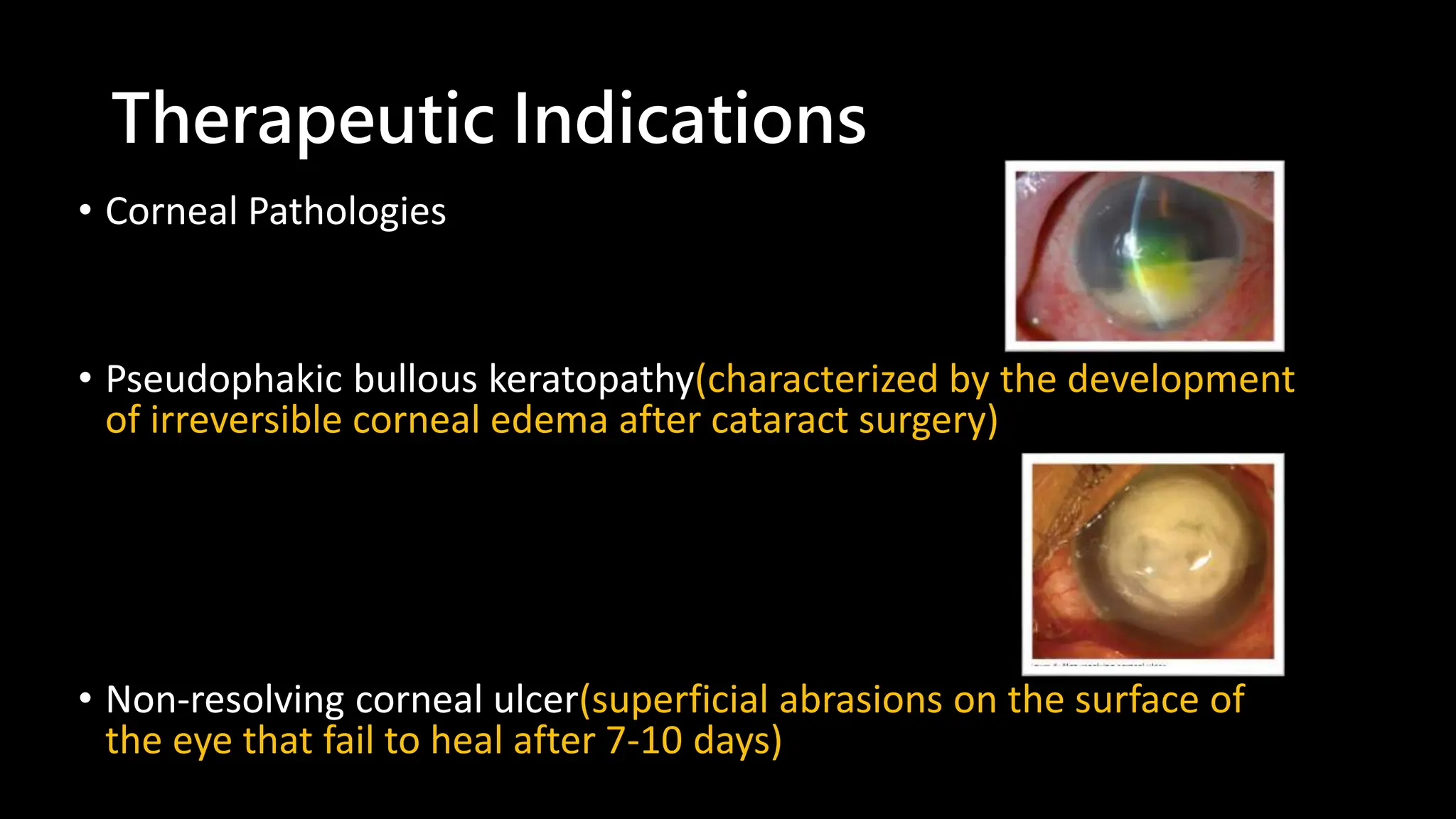 06 Indications & Contra Indications of Contact Lenses.pptx