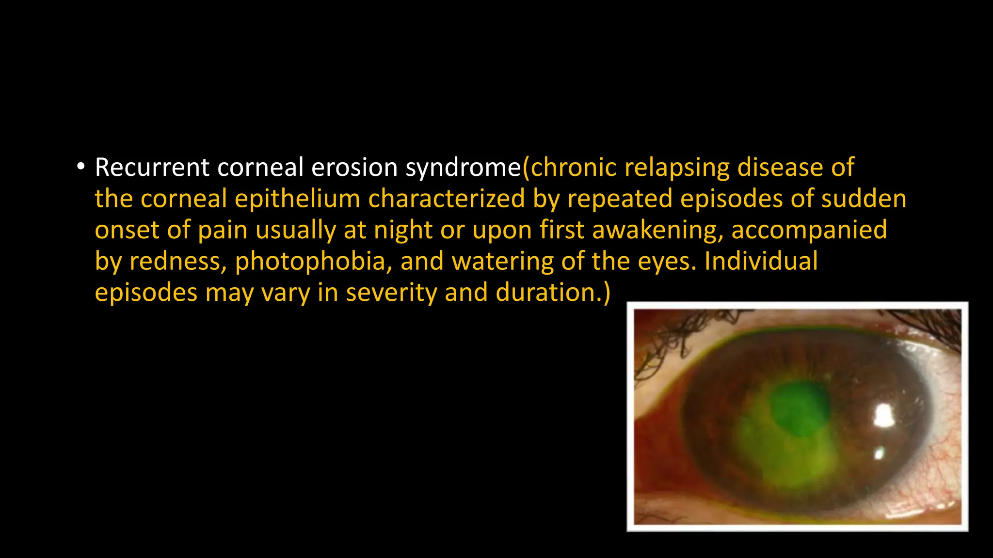 06 Indications & Contra Indications of Contact Lenses.pptx