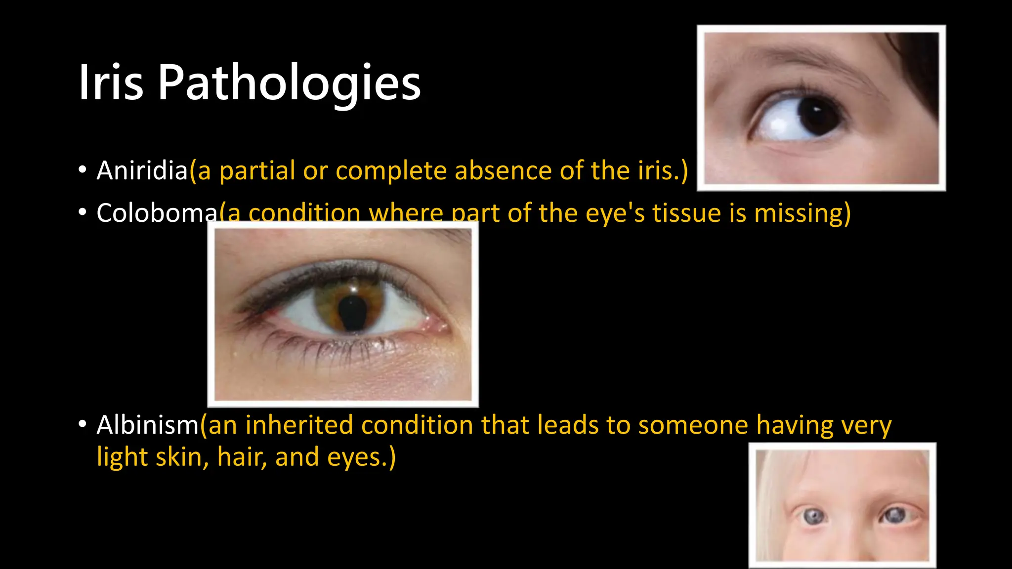 06 Indications & Contra Indications of Contact Lenses.pptx