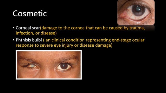 06 Indications & Contra Indications of Contact Lenses.pptx