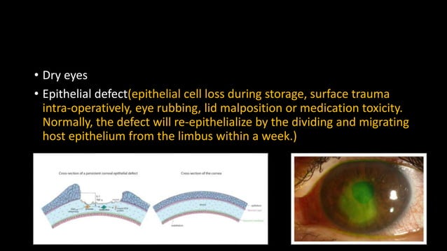 06 Indications & Contra Indications of Contact Lenses.pptx
