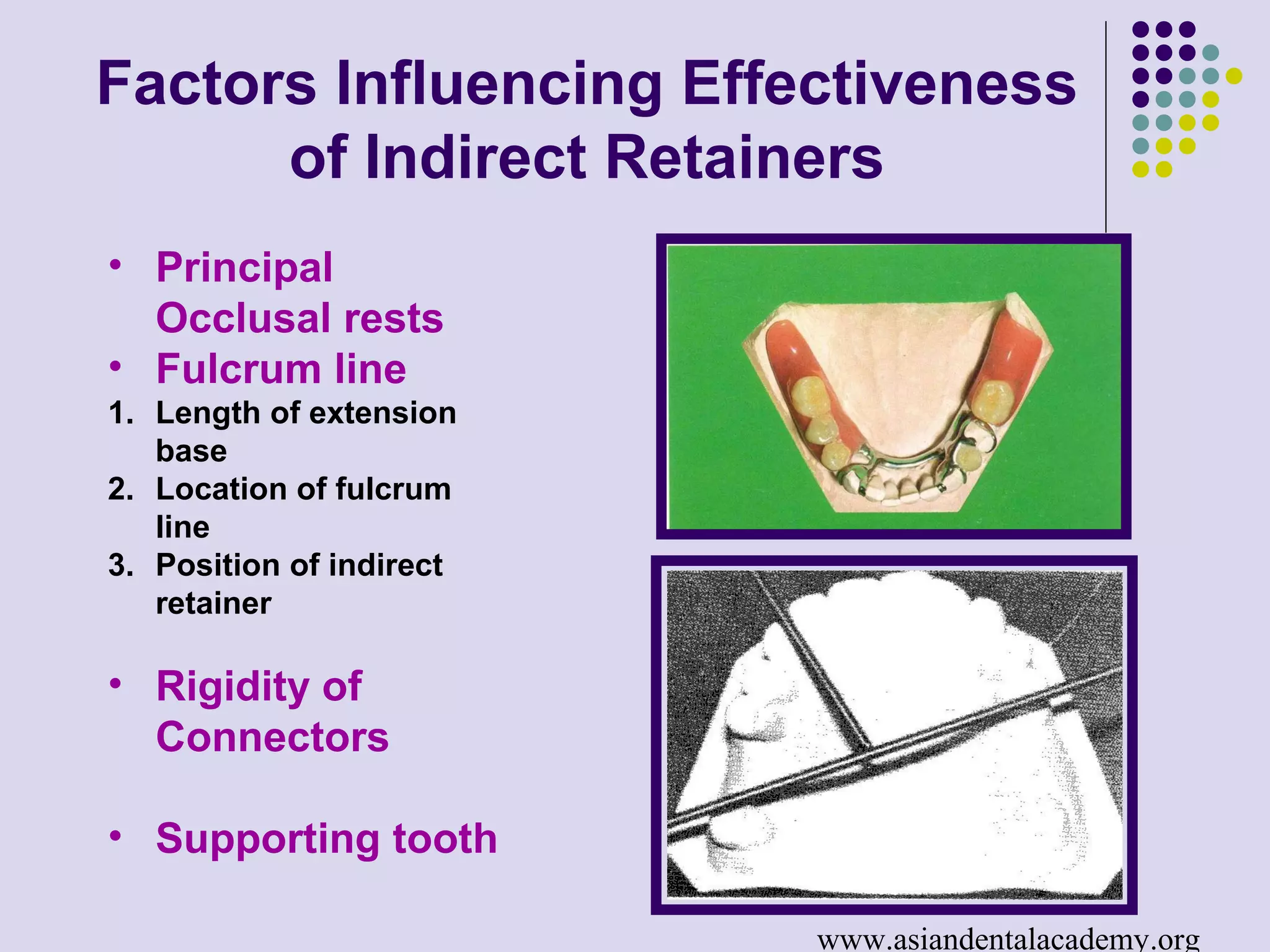 indirect retainers for Removable Partial Dentures | PPT