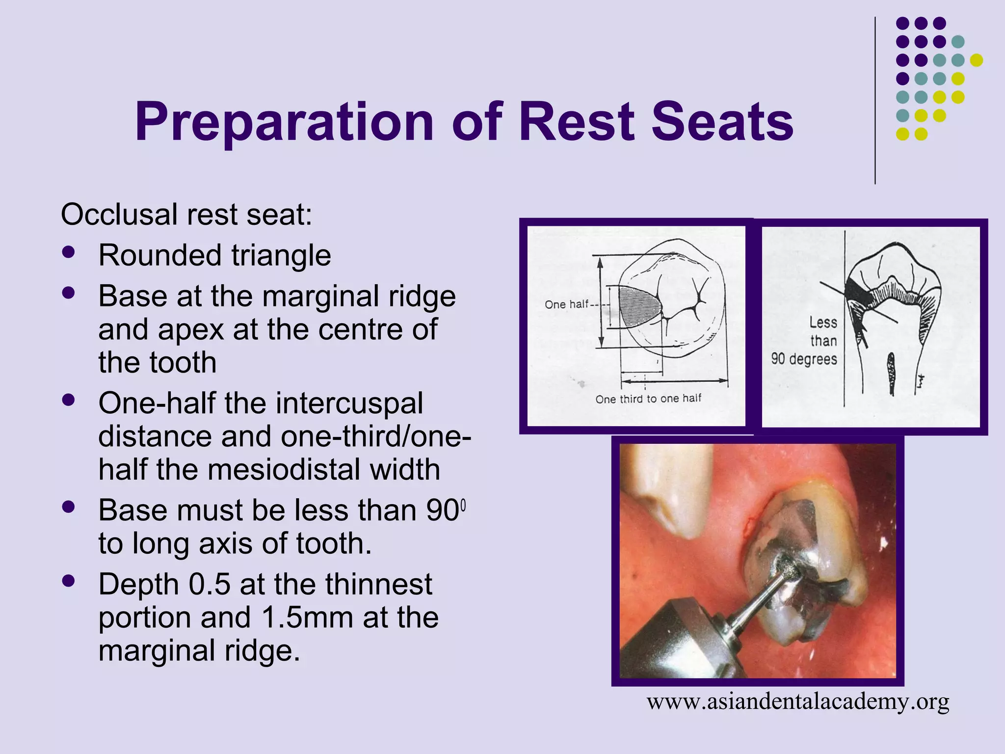 indirect retainers for Removable Partial Dentures | PPT