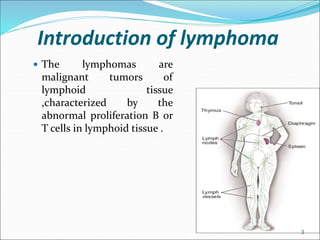 06 Lymphoma-1.ppt