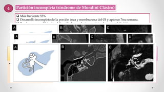 Malformaciones Congenitas del Oido | PPTX