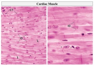 Muscle Tissue - Histology Slides Types of Muscle Tissue | PPT