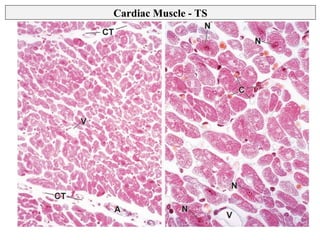 Muscle Tissue - Histology Slides Types of Muscle Tissue | PPT