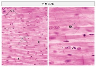 Muscle Tissue - Histology Slides Types of Muscle Tissue | PPT
