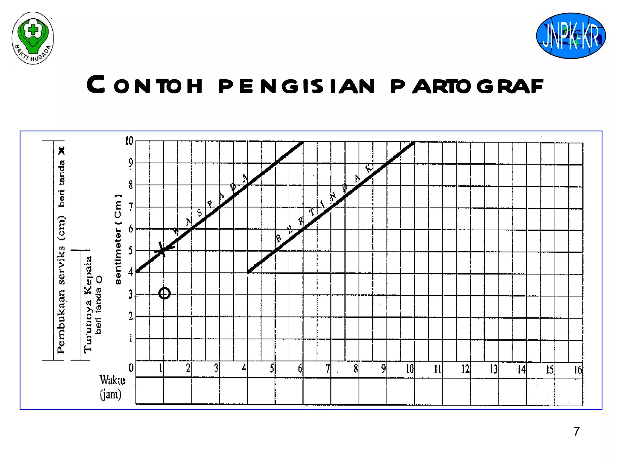 06 partograf | PPT