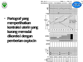 06 partograf | PPT