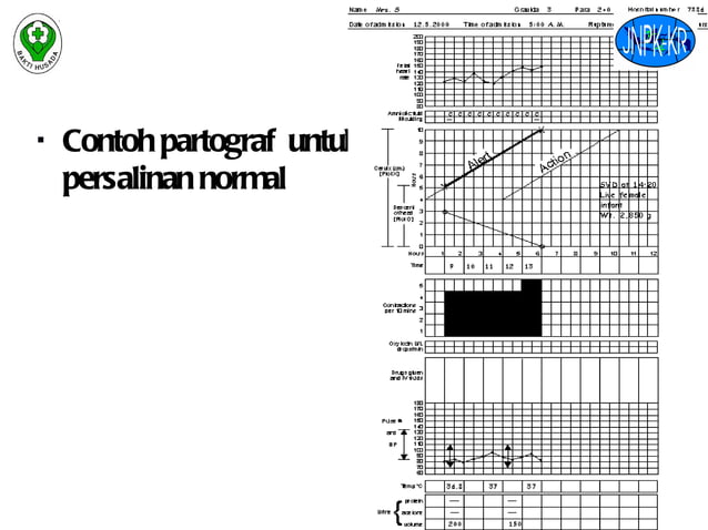 06 partograf | PPT