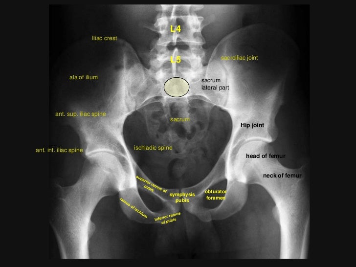 pelvis