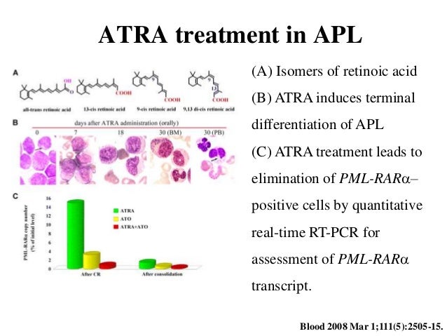 Acute Promyelocytic Leukemia