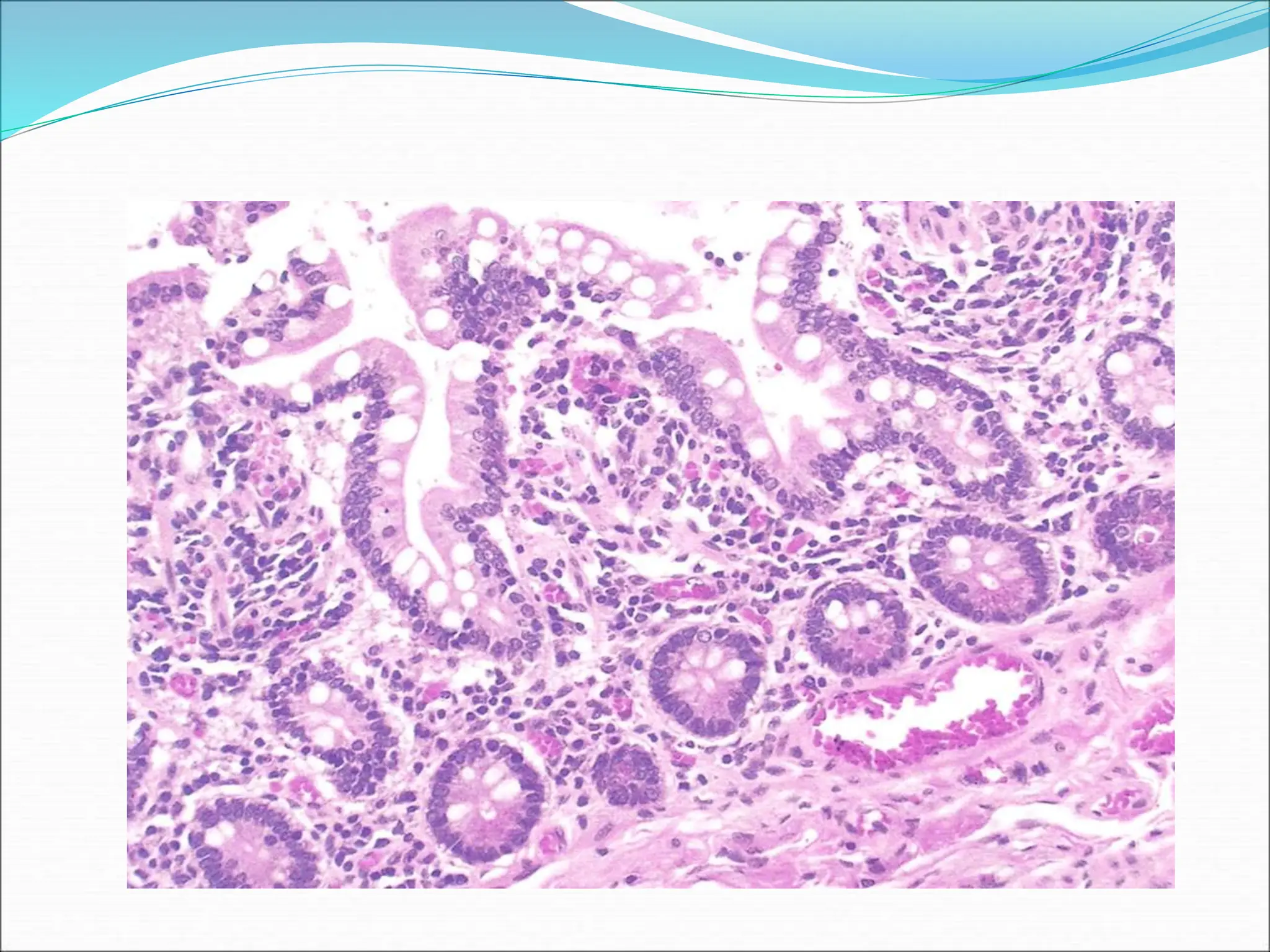 procedure for Staining on routine histopath.ppt