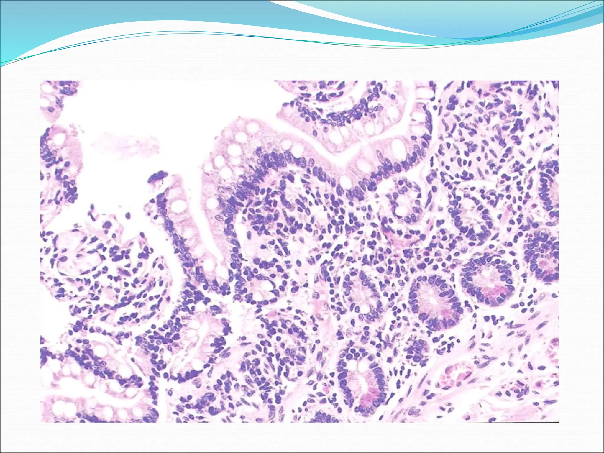 procedure for Staining on routine histopath.ppt