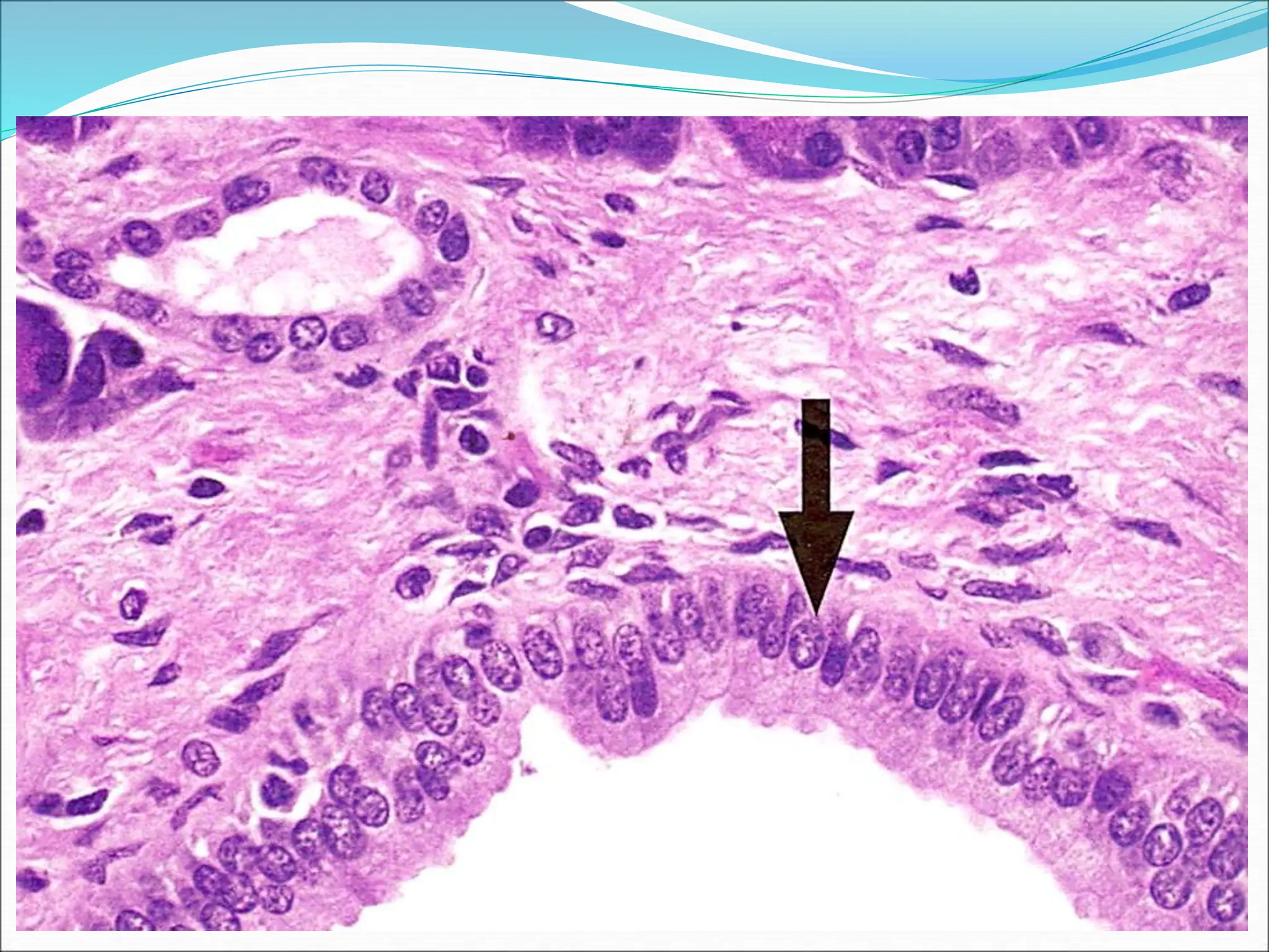 procedure for Staining on routine histopath.ppt