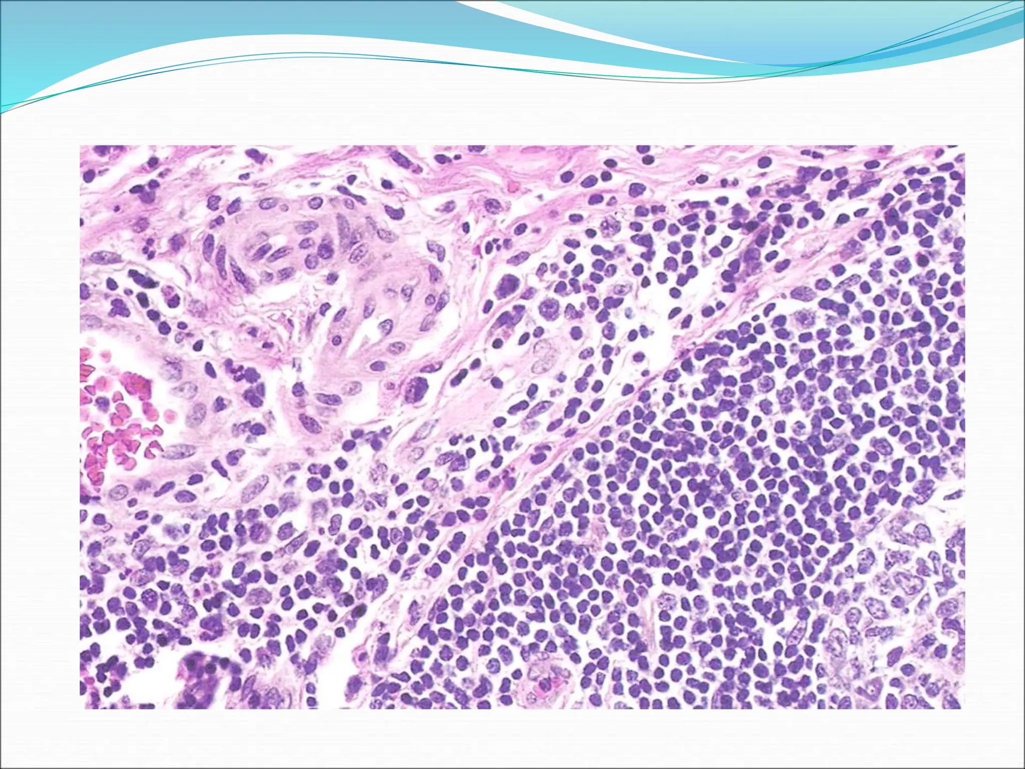 procedure for Staining on routine histopath.ppt