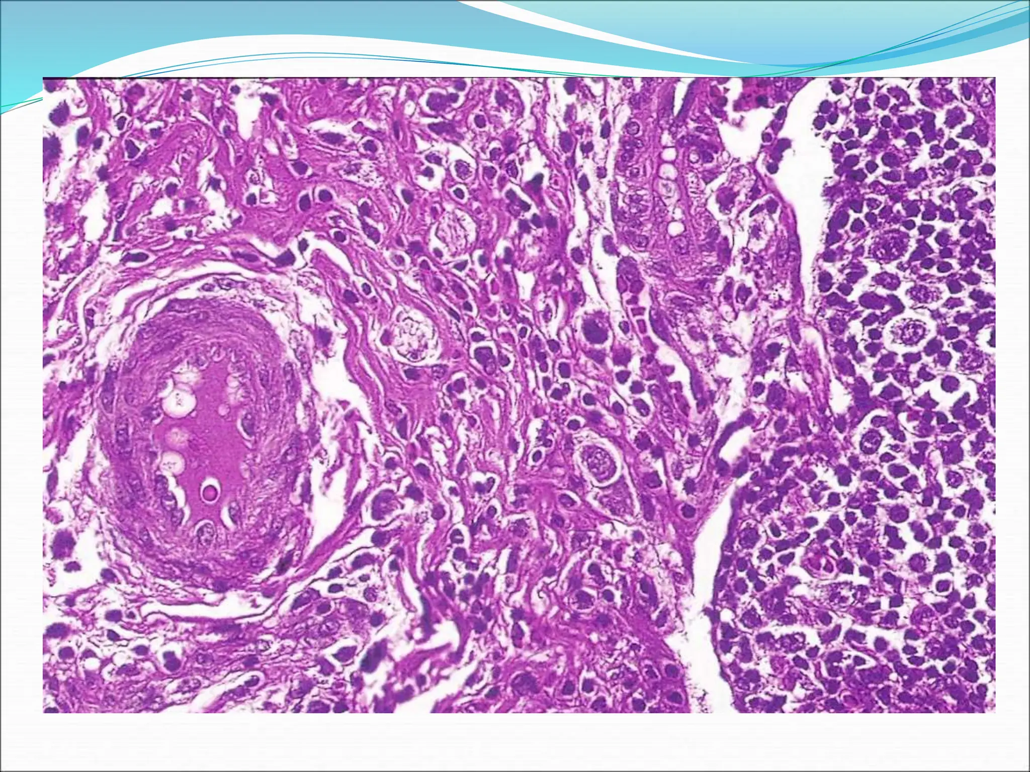 procedure for Staining on routine histopath.ppt