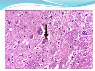 procedure for Staining on routine histopath.ppt