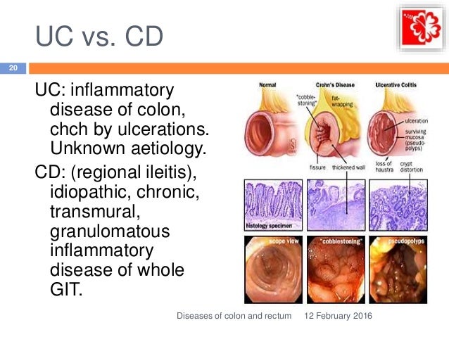 06 surgical disease colon and rectum tutorial hajhamad m msu
