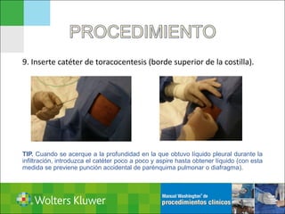 Como realizar una toracocentesis evacuatoria | PDF