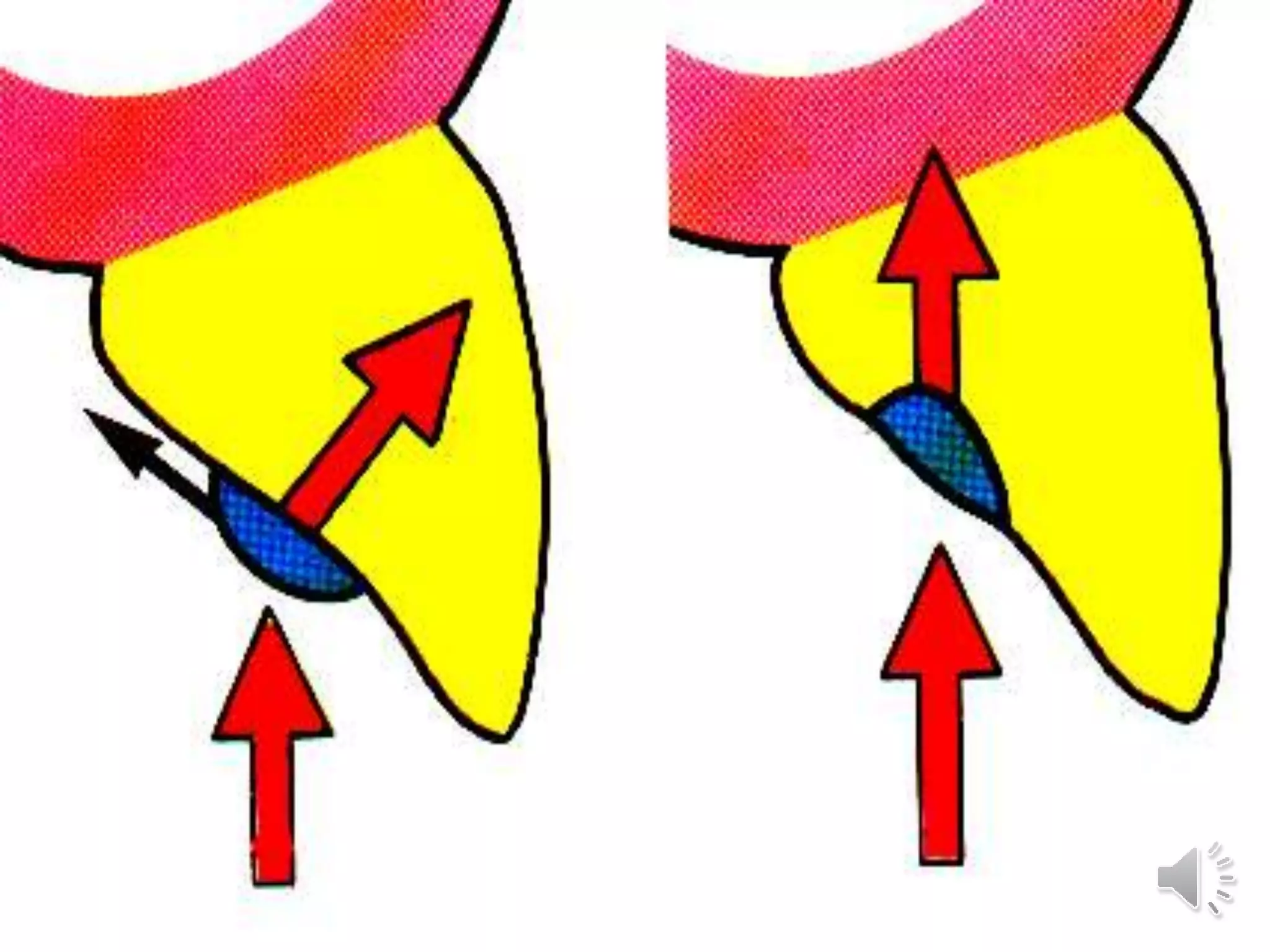 b- Types of tooth rests | PPT