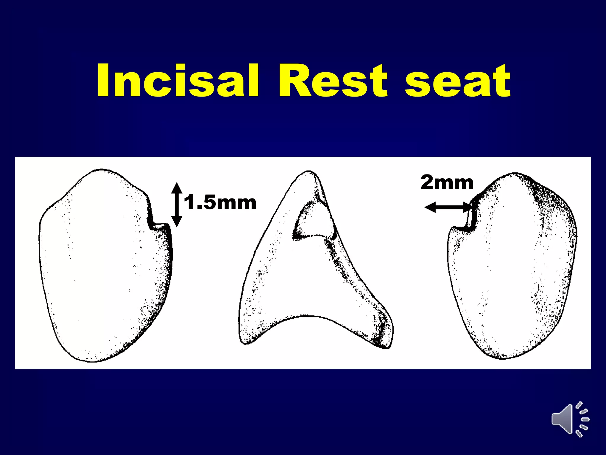 b- Types of tooth rests | PPT