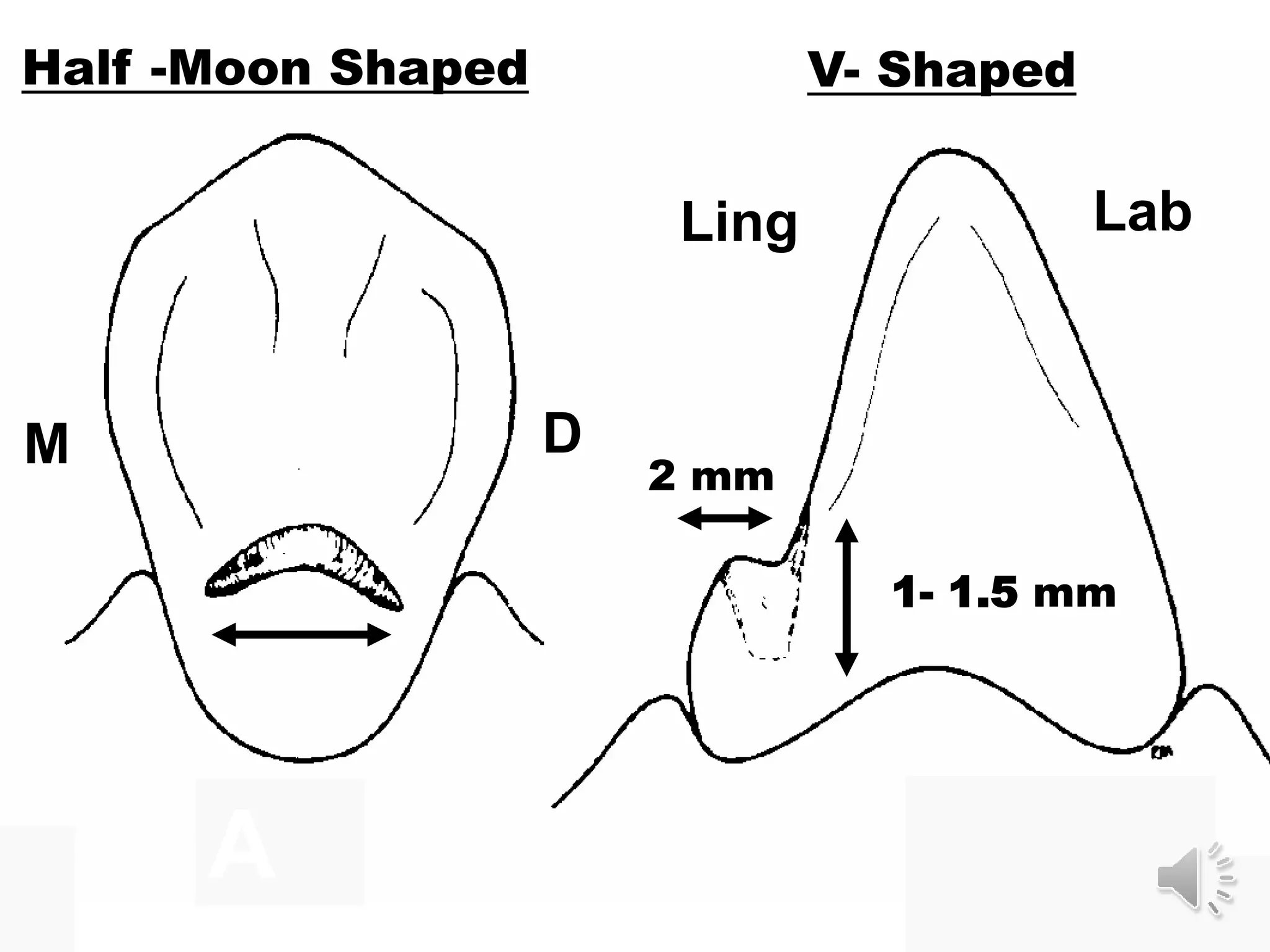 b- Types of tooth rests | PPT
