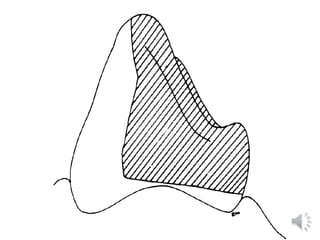 b- Types of tooth rests | PPT