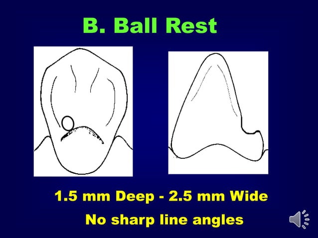 b- Types of tooth rests | PPT | Dental Health | Diseases and Conditions
