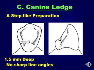 b- Types of tooth rests | PPT