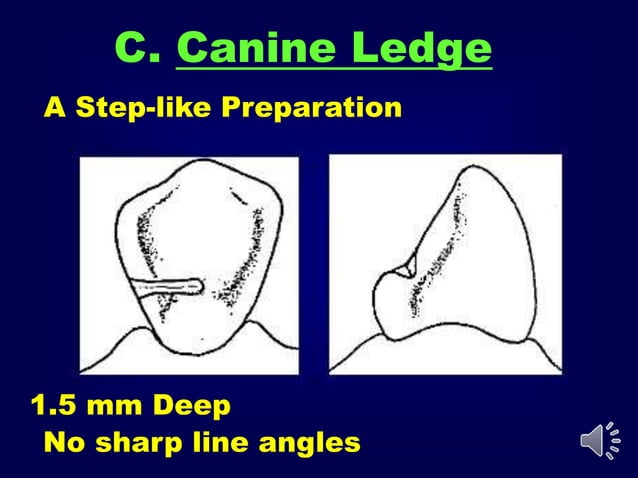 b- Types of tooth rests | PPT | Dental Health | Diseases and Conditions