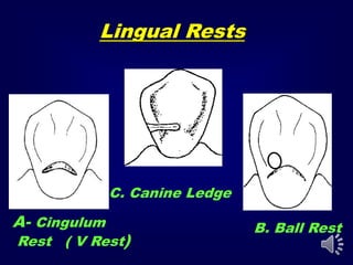 b- Types of tooth rests | PPT